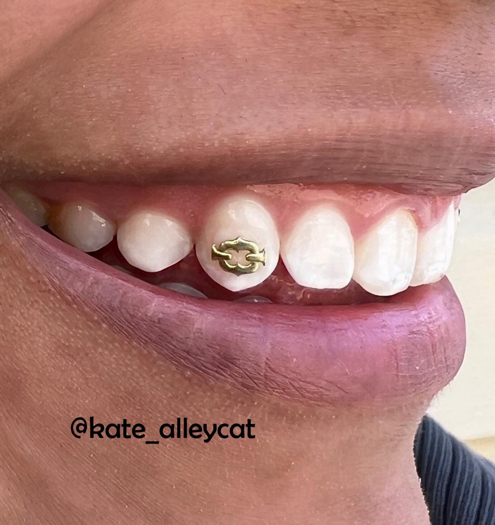 Chain Link 18k Gold Tooth Charm - Etsy