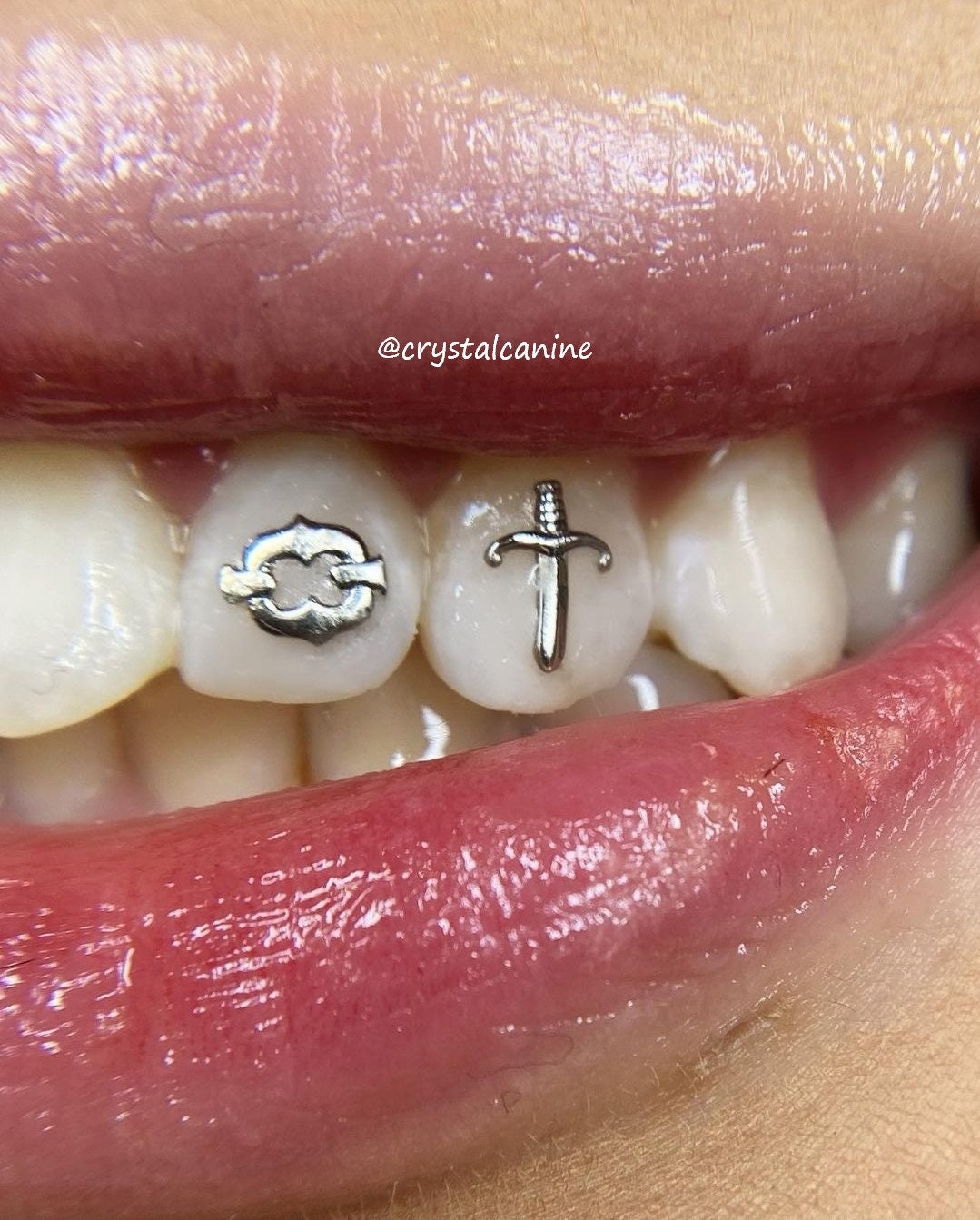 Chain Link 18k Gold Tooth Charm - Etsy