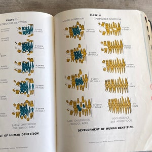 Vintage Medical Dictionary Blackston Gould Color Plates as Is - Etsy