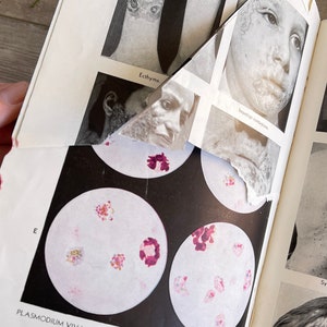 Vintage Medical Dictionary Blackston Gould Color Plates as Is - Etsy