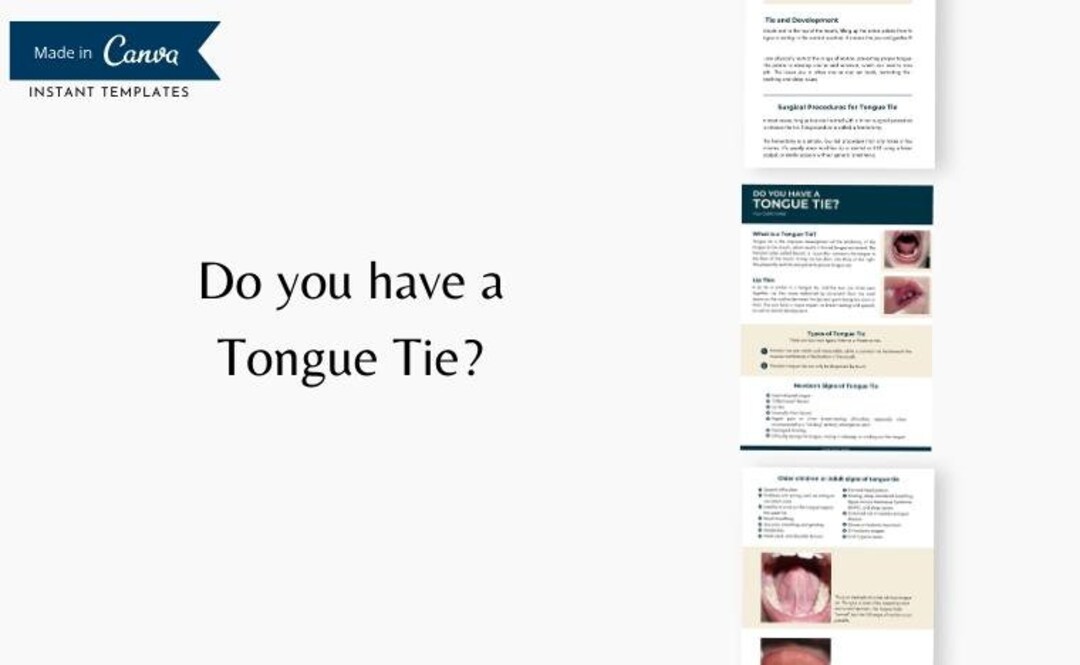 Tongue Tie Handout - Educational Canva Template - Etsy