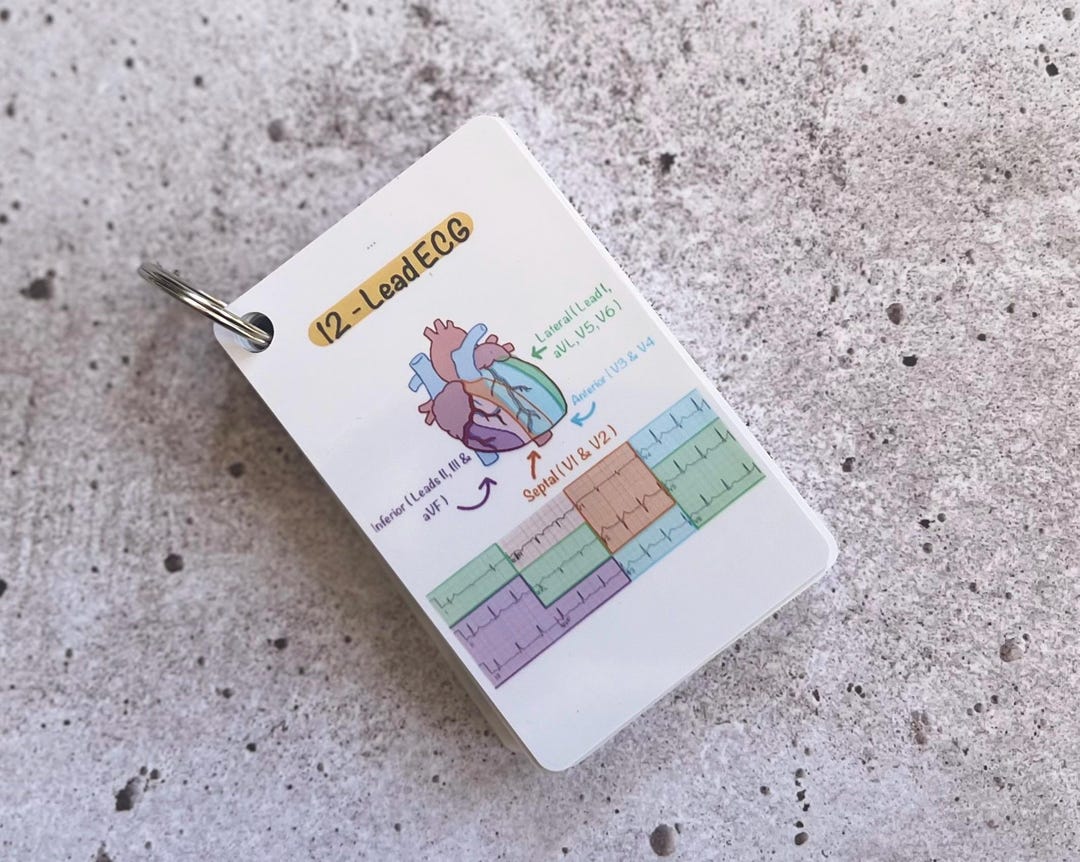 ECG Reference Cards - Etsy