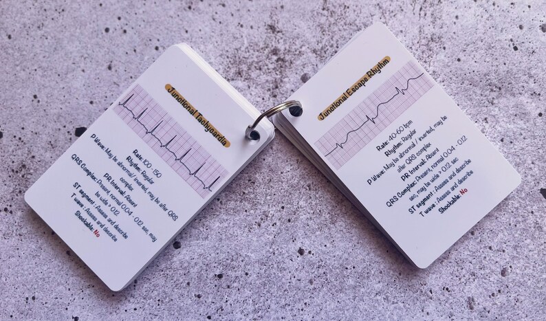ECG Reference Cards - Etsy