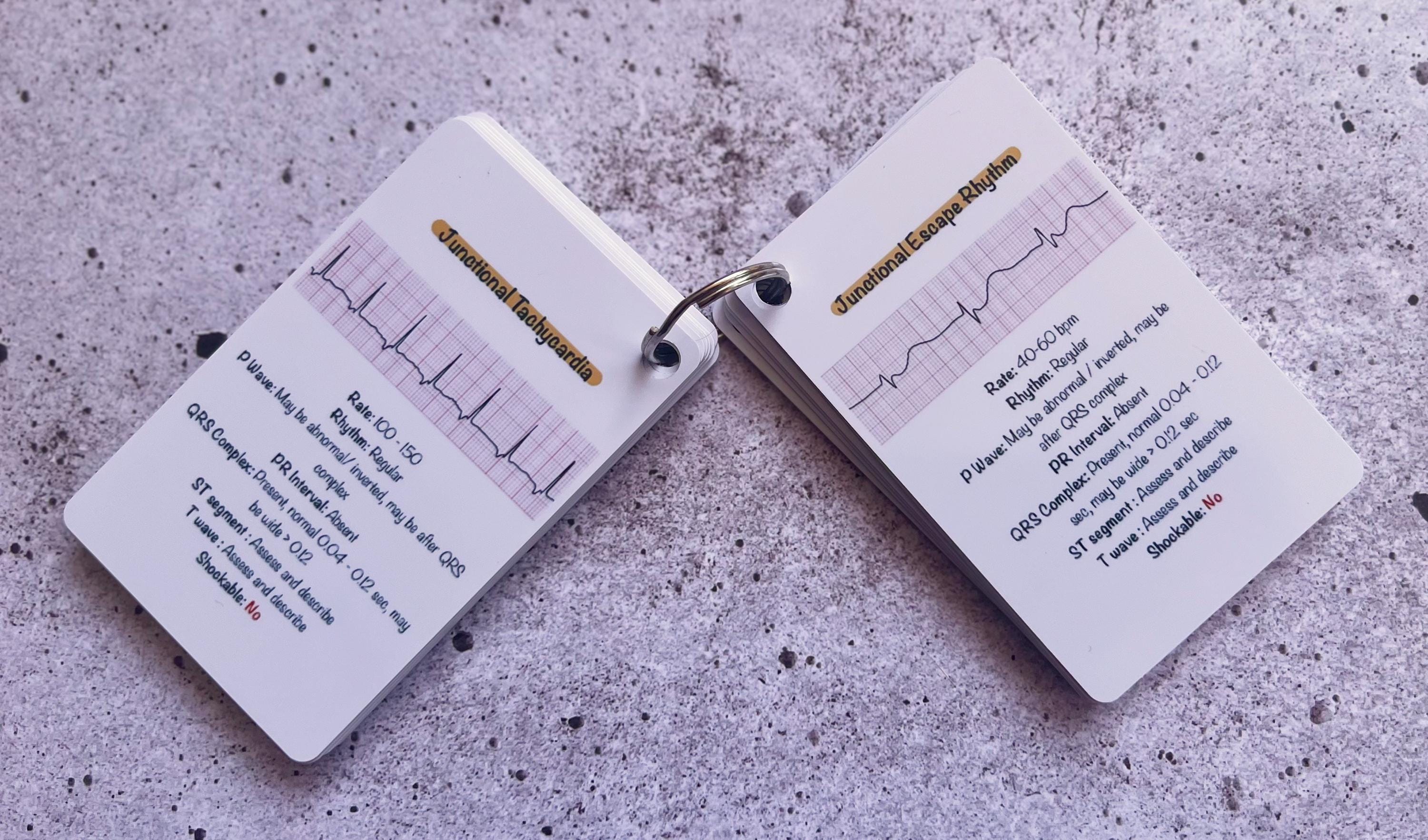 ECG Reference Cards - Etsy