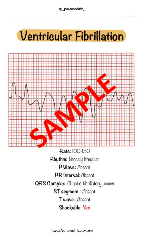 ECG Reference Cards DIGITAL - Etsy
