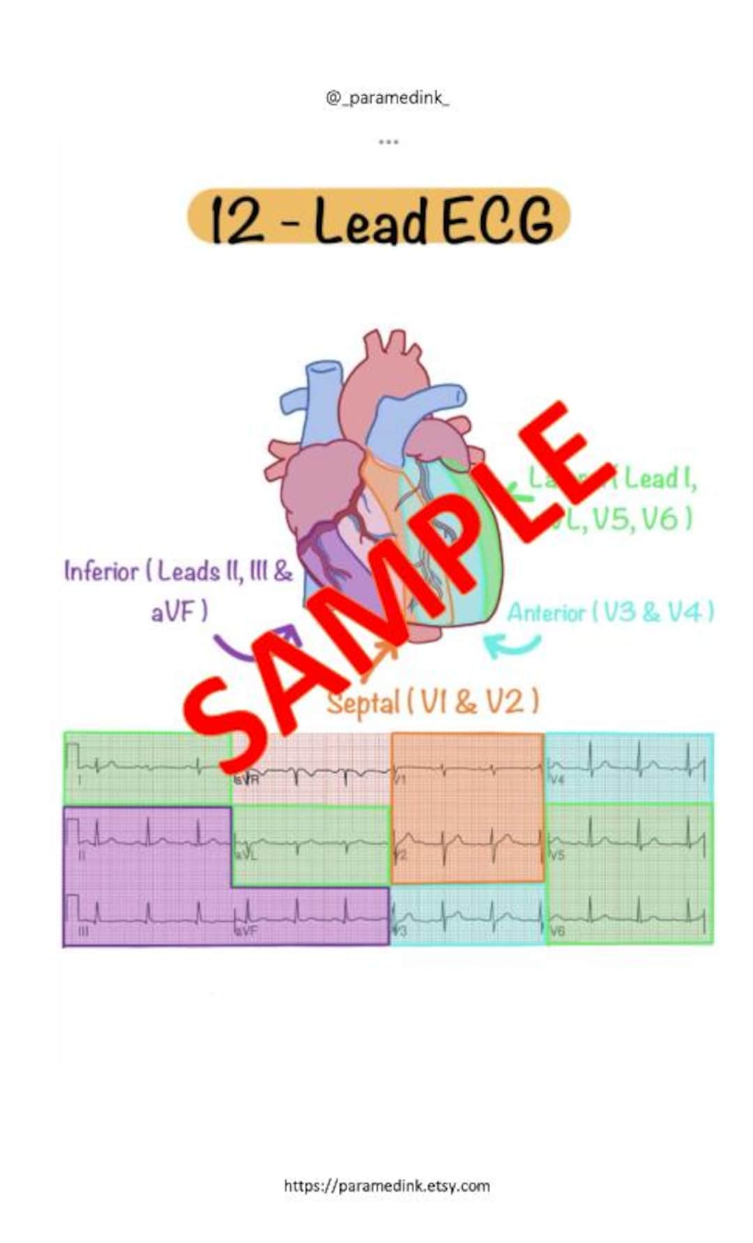 ECG Reference Cards DIGITAL - Etsy