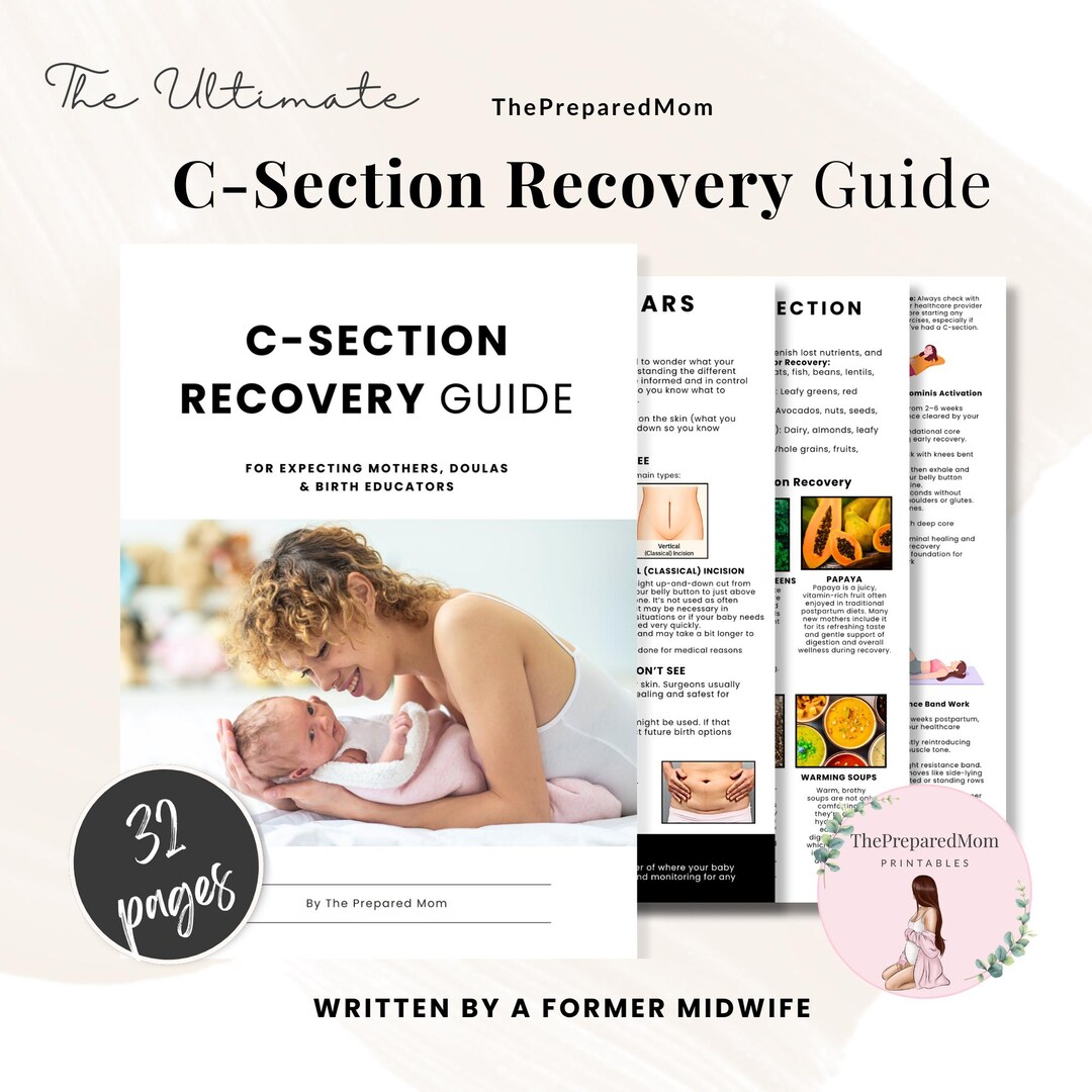 C Section Recovery Guide, Cesarean Healing Manual, Printable Doula ...