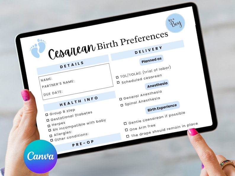 Editable C Section Birth Plan Template for Boy, Pastel Blue Cesarean ...