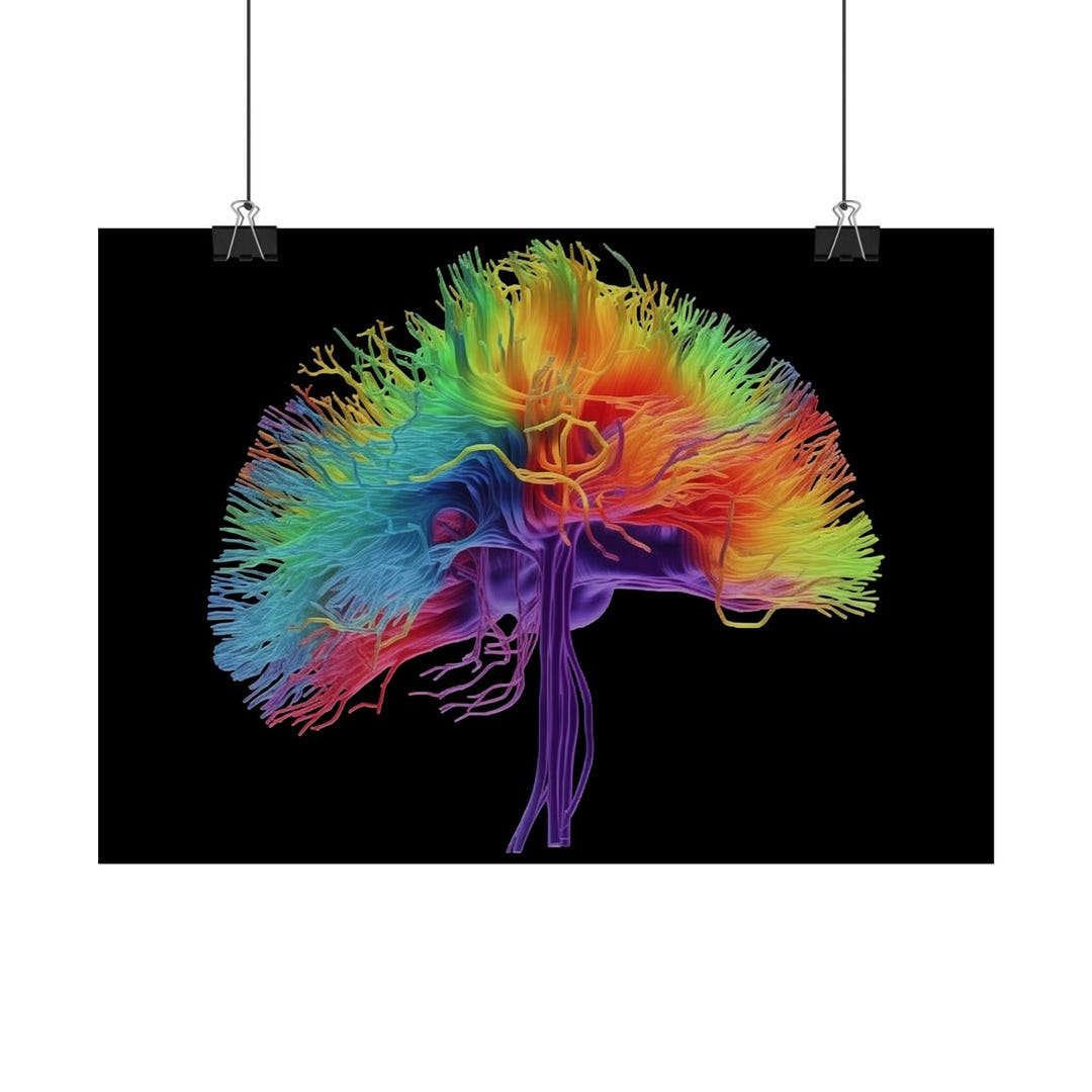 Vibrant Brain Art - Scientific Neuro Imaging Poster - Colorful MRI ...