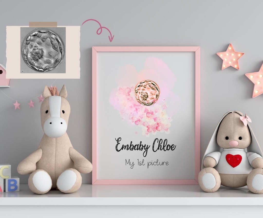 Embryo IVF Watercolor Rendition From Embryo Picture Customizable Color ...