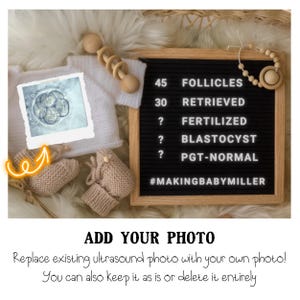 Digital IVF Egg Retrieval Letter Board Template With Embryo Picture ...