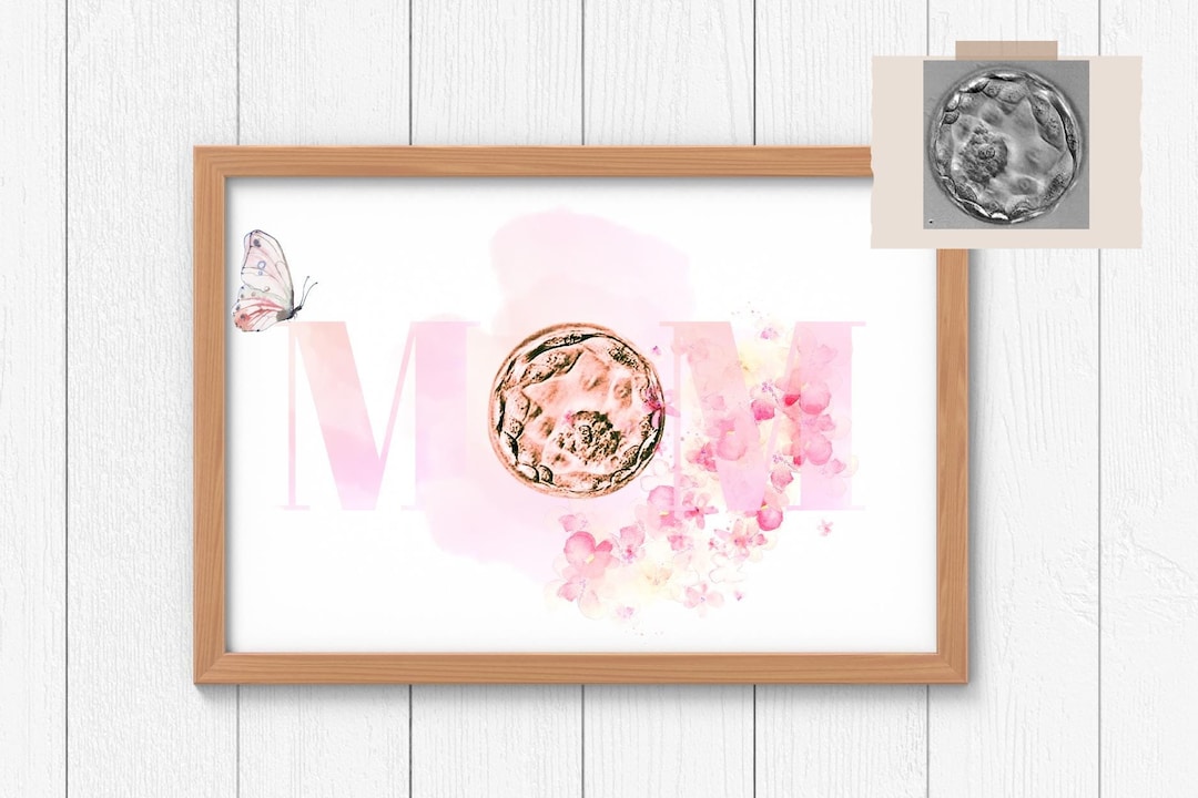 IVF Mom Gift: Custom Embryo Watercolor Art, Framed Nursery Decor - Etsy