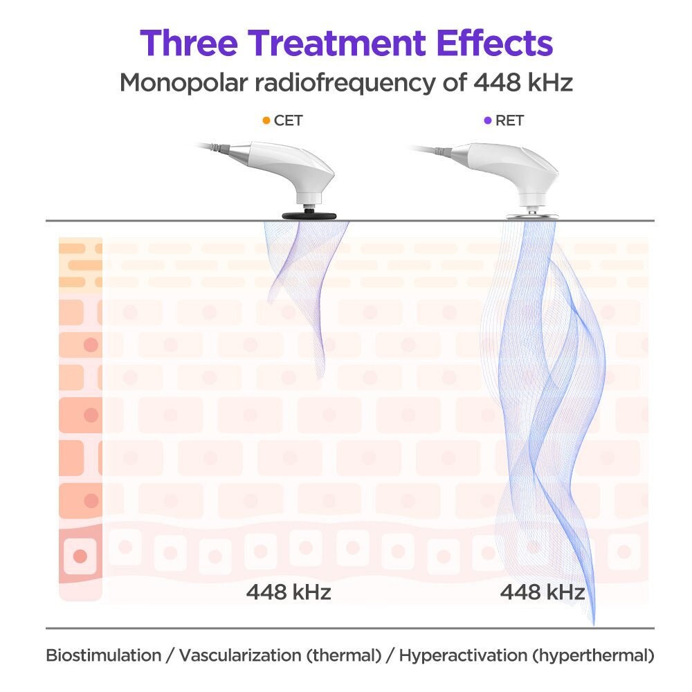 Shape Tactics Skin Tightening Machine: Advanced Radio Frequency Body ...