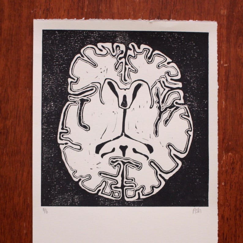 Brain Scans - Original Linocut Print - Etsy