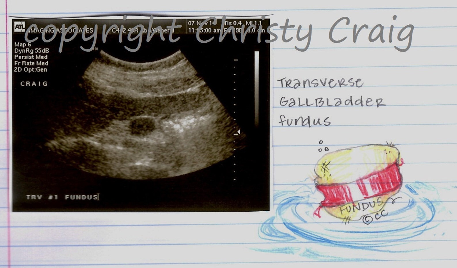 Shark Gallbladder Series of 3 Prints - Etsy