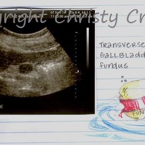 Shark Gallbladder Series of 3 Prints - Etsy