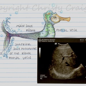 Mermaid Sign Portal Vein Print - Etsy