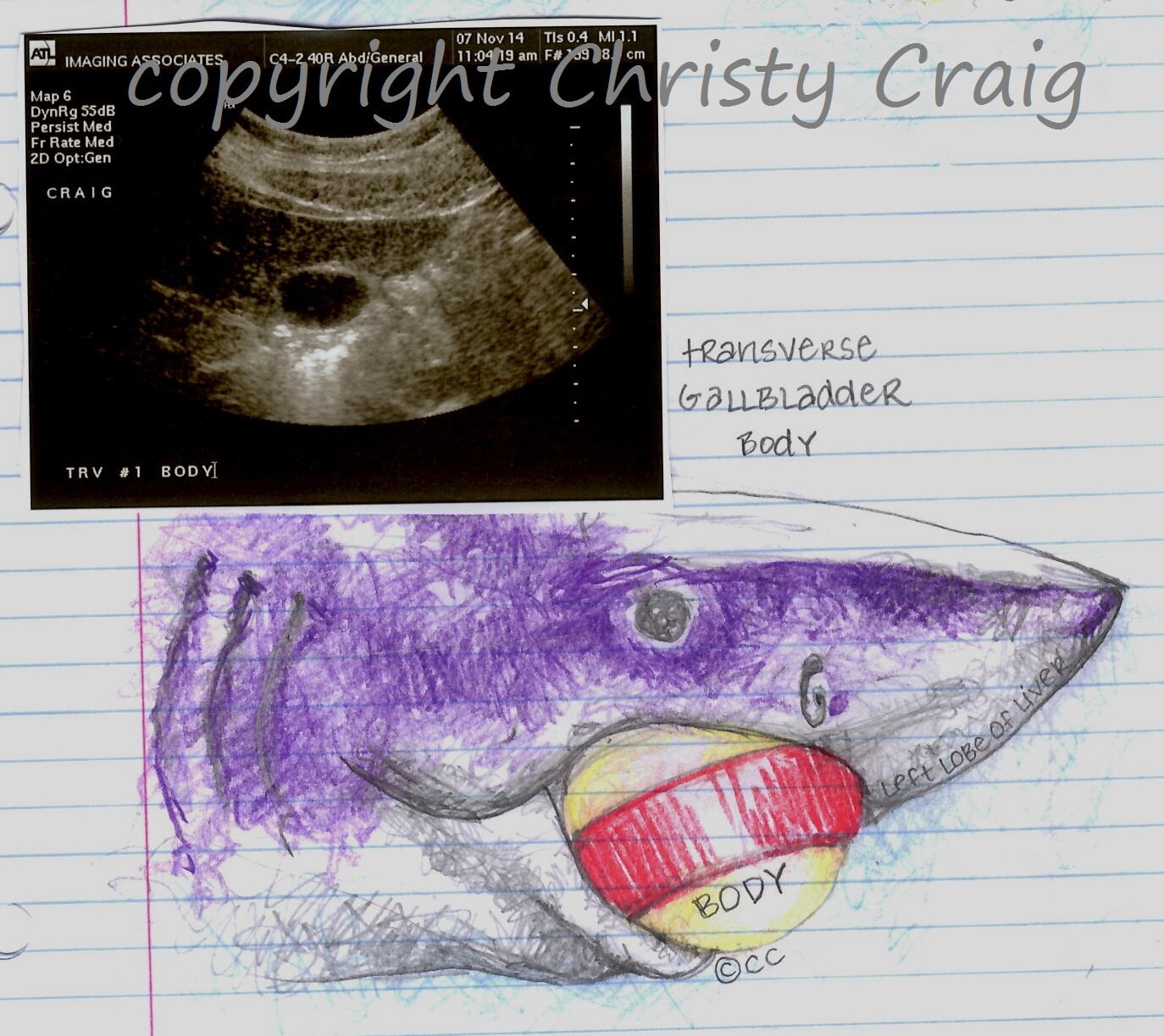 Shark Gallbladder Series of 3 Prints - Etsy