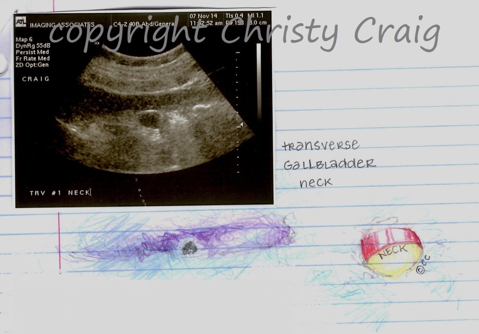 Shark Gallbladder Series of 3 Prints - Etsy