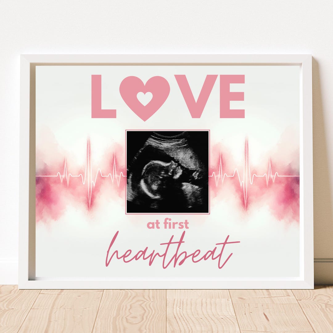 Baby Ultrasound Gift Idea Editable Template Add Your Own Sonogram Photo ...