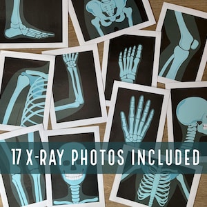 Doctor Pretend Play, Printable X-ray Role Play, Hospital Pretend Play ...