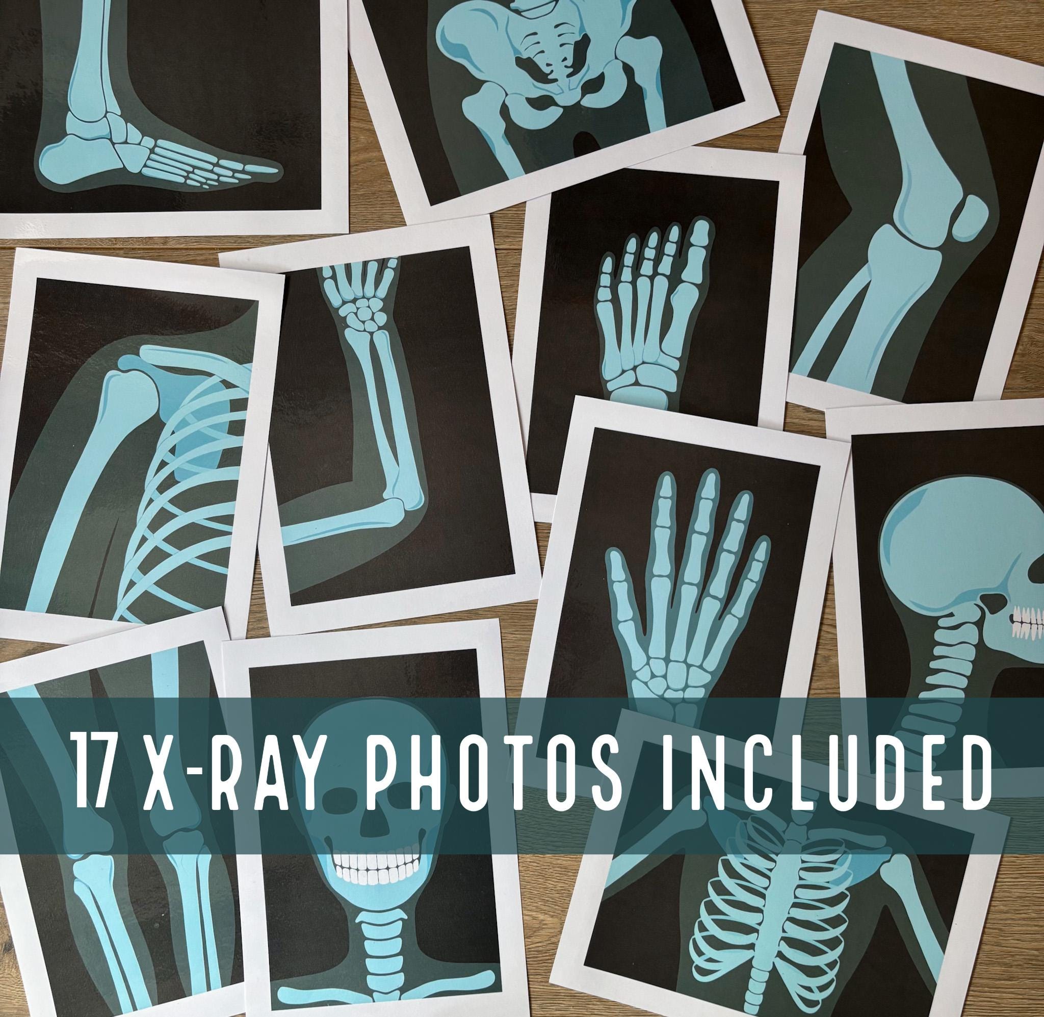 Doctor Pretend Play, Printable X-ray Role Play, Hospital Pretend Play ...