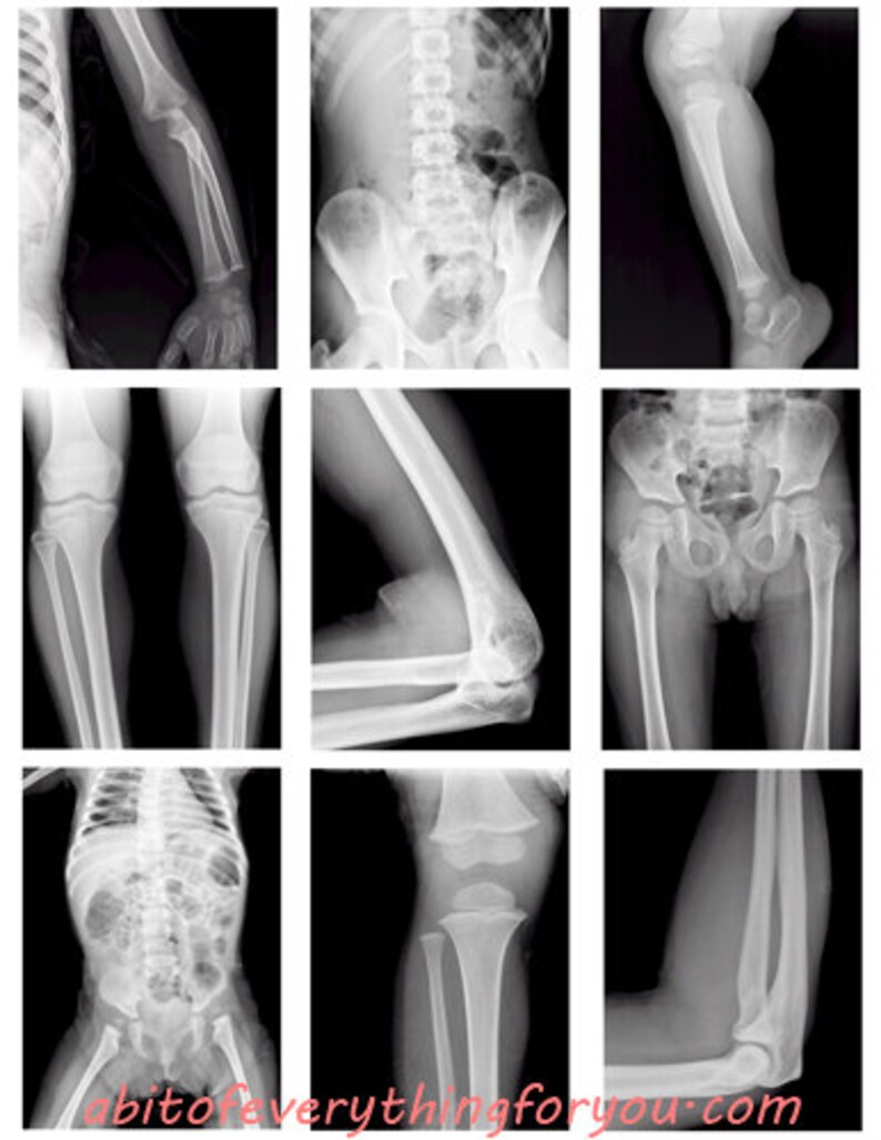 Human Body X Rays Photo Collage Sheet Digital Download Etsy