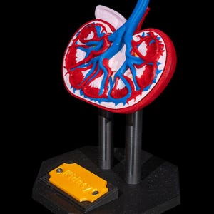 3D Printed Kidney Model – A Detailed Educational Tool for Renal Anatomy ...
