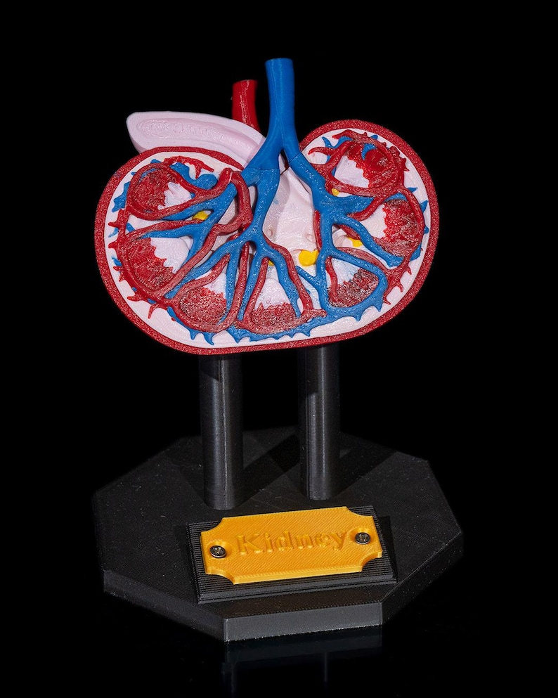 3D Printed Kidney Model – A Detailed Educational Tool for Renal Anatomy ...