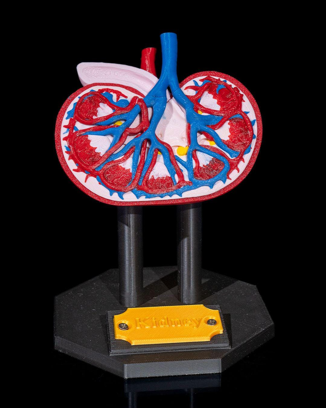 3D Printed Kidney Model – A Detailed Educational Tool for Renal Anatomy ...