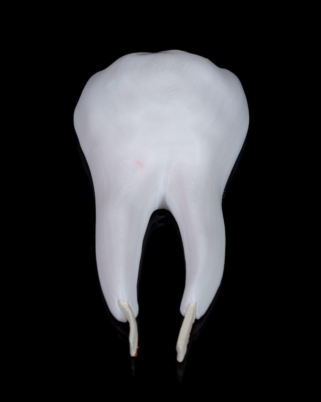 3D Printed Premolar Tooth Model – A Detailed Educational Tool for ...