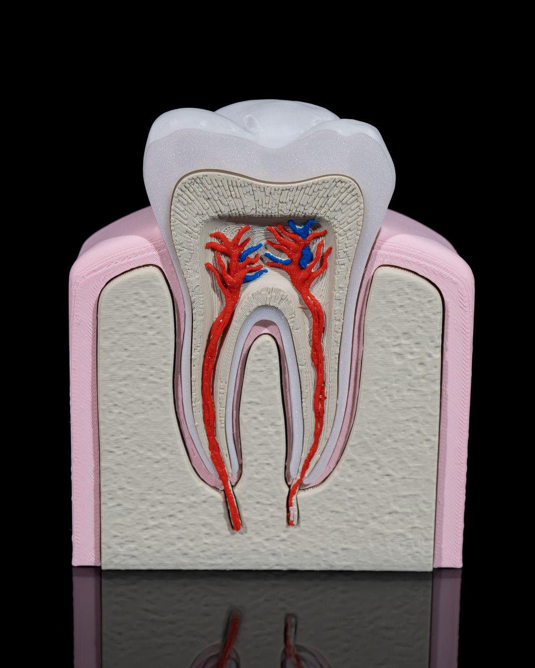 3D Printed Premolar Tooth Model – A Detailed Educational Tool for ...