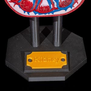 3D Printed Kidney Model – A Detailed Educational Tool for Renal Anatomy ...