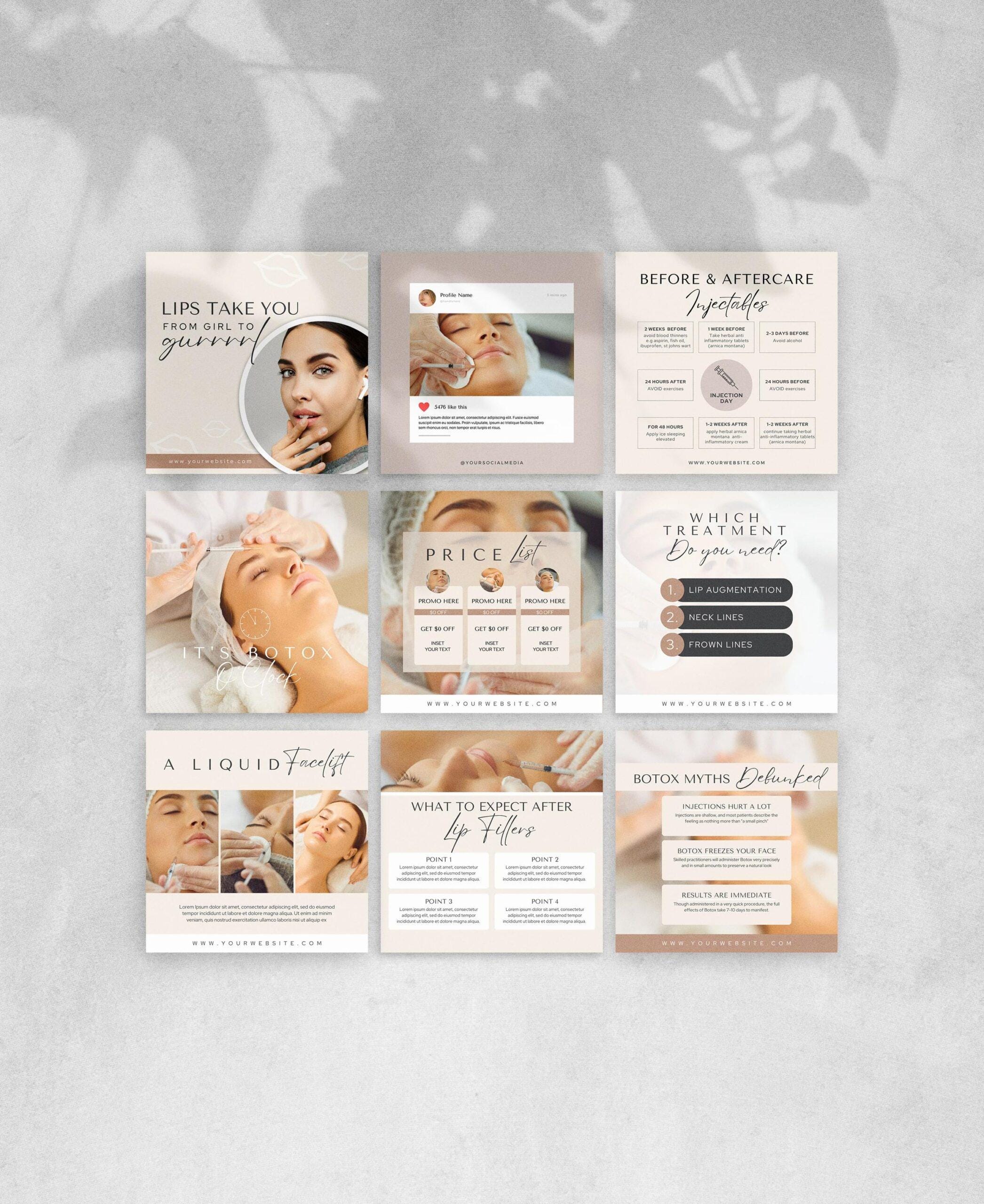 50 Botox and Filler Instagram Posts, Social Media Manager Bundle ...