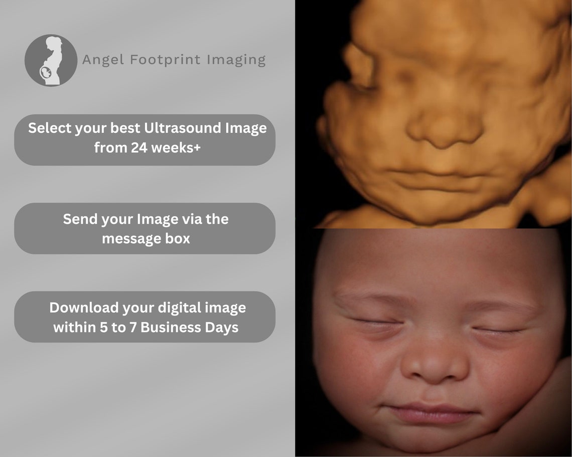 8K Hyper Realistic Ultrasound Real View Image Pregnancy Keepsake High ...