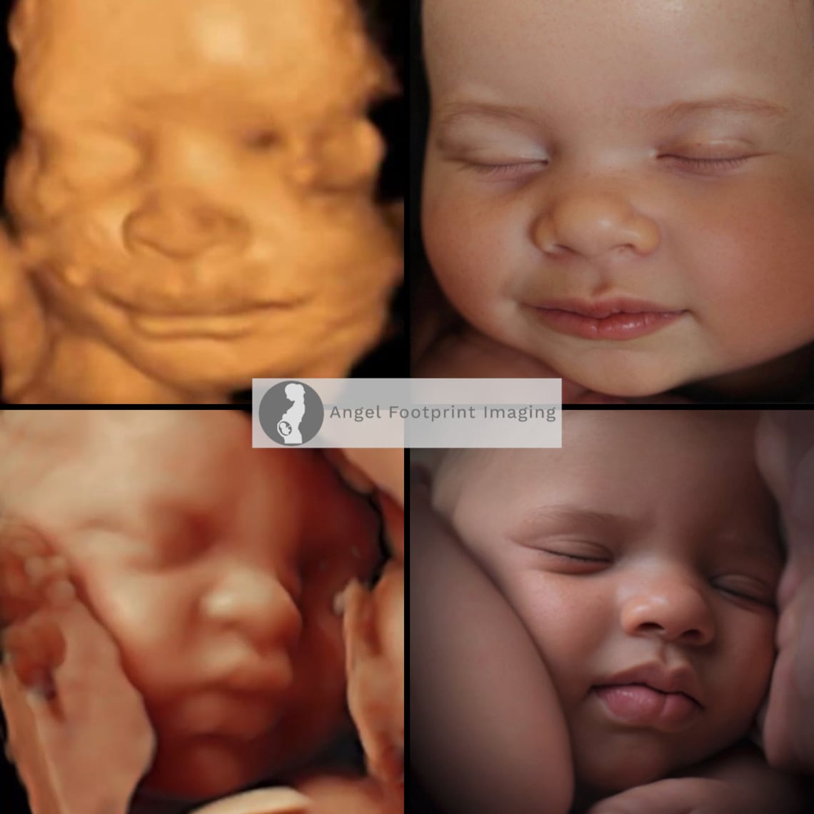 8K Hyper Realistic Ultrasound Real View Image Pregnancy Keepsake High ...