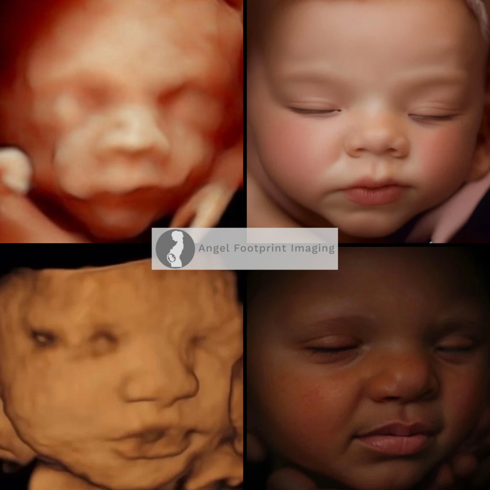 8K Hyper Realistic Ultrasound Real View Image Pregnancy Keepsake High ...
