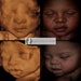 8K Hyper Realistic Ultrasound Real View Image Pregnancy Keepsake High ...