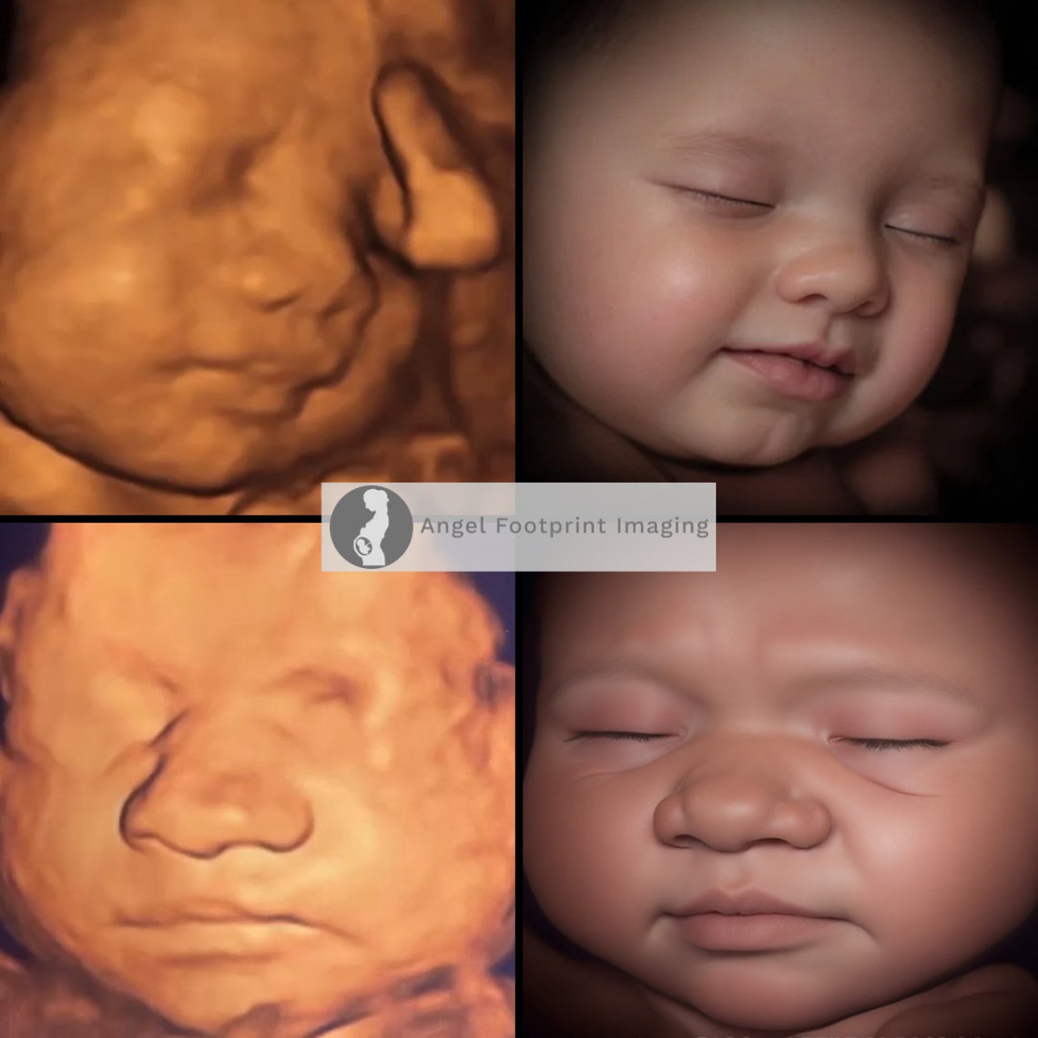 8K Hyper Realistic Ultrasound Real View Image Pregnancy Keepsake High ...