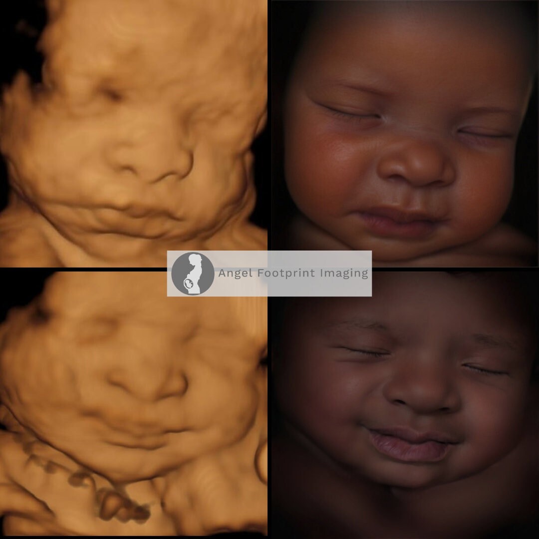 8K Hyper Realistic Ultrasound Real View Image Pregnancy Keepsake High ...