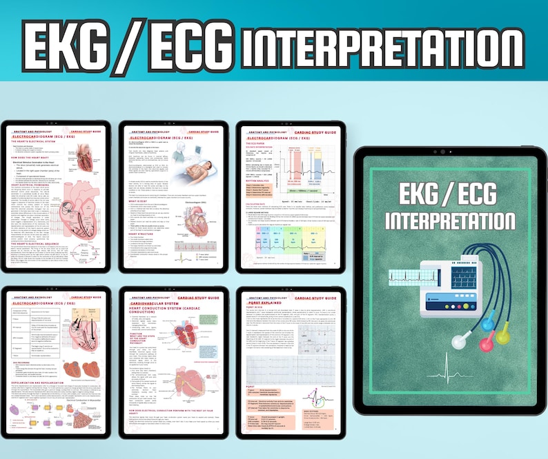 EKG ECG Interpretation | Nursing Cardiac Study Guide | EKG Rhythms ...