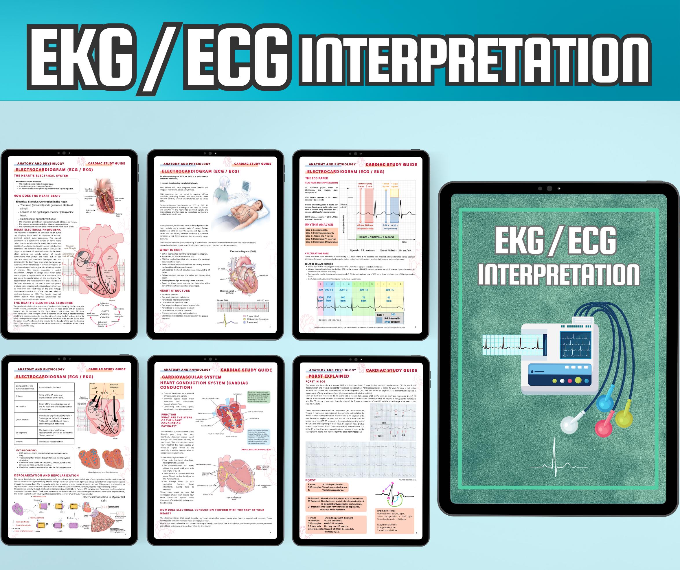 EKG ECG Interpretation | Nursing Cardiac Study Guide | EKG Rhythms ...