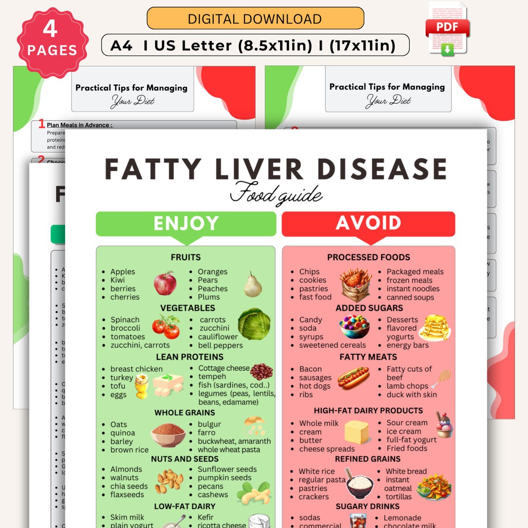 Foods to Avoid for Nafld or Nash Fatty Liver Disease Food List Pdf ...