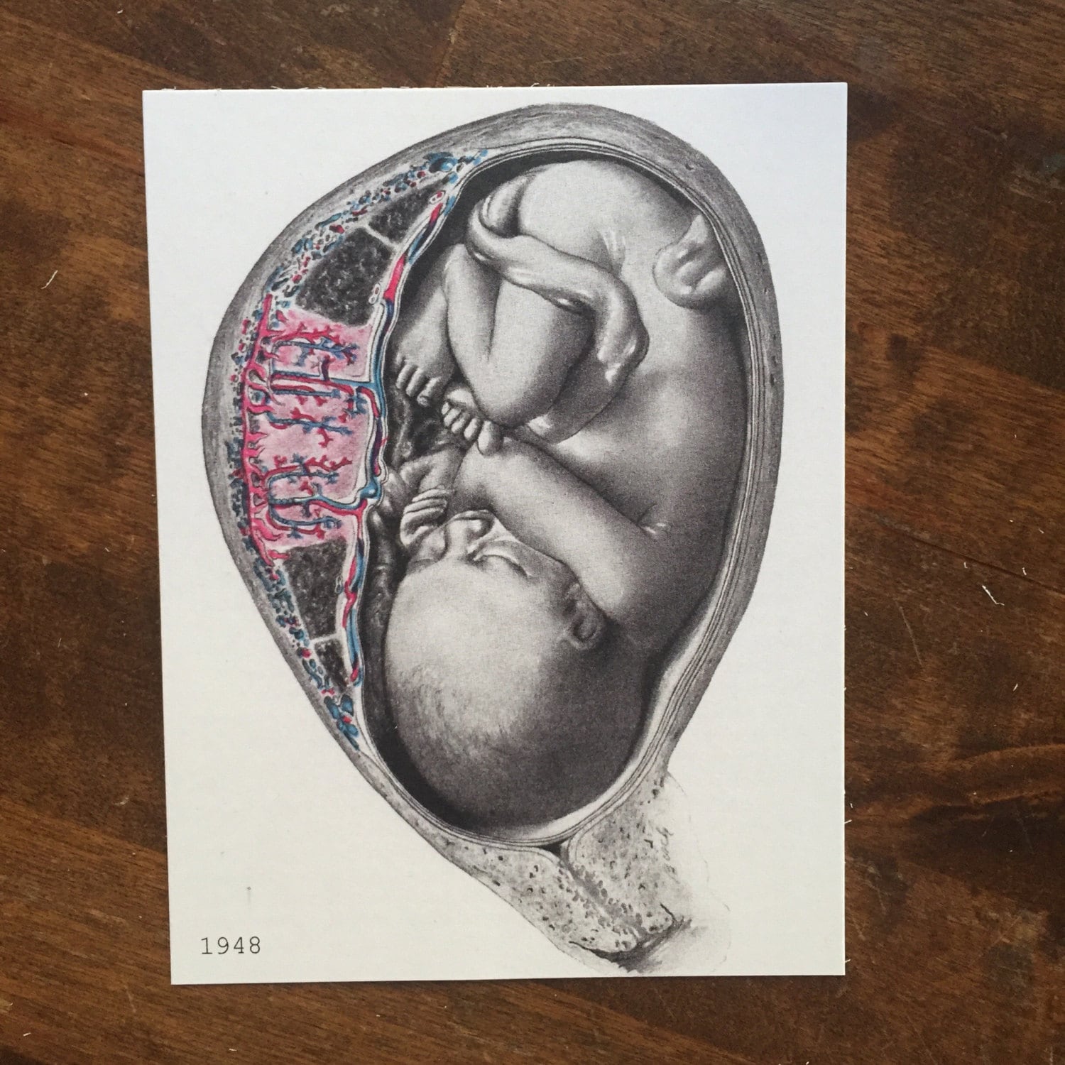 Full Term Fetus Postcards Set of 5 - Etsy