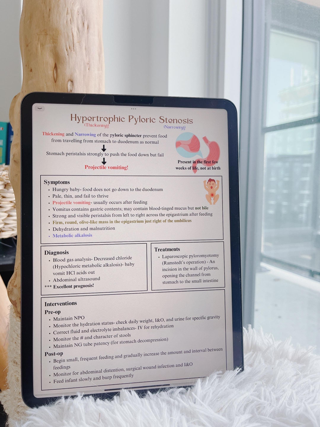 Pediatric GI System Nursing Notes | NCLEX Review (PDF) - Etsy
