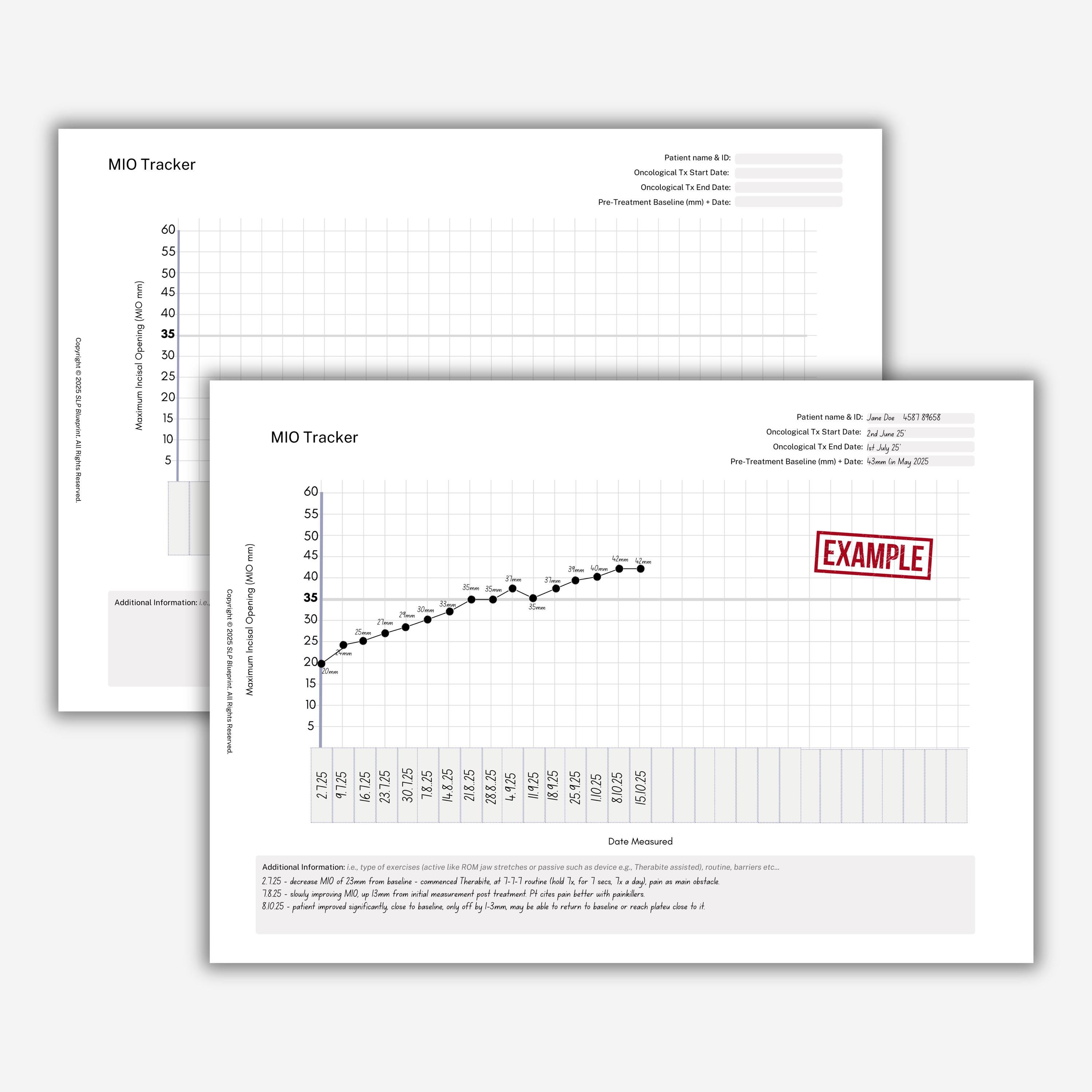 MIO Tracker: Trismus Rehabilitation Chart for Slps (PDF) - Etsy