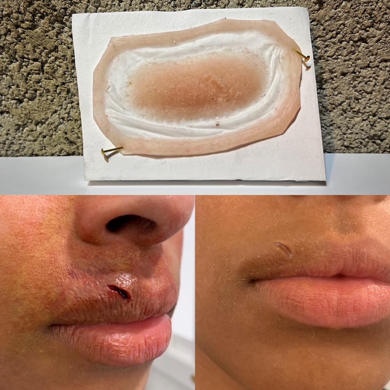 Prosthetic Lips - Etsy