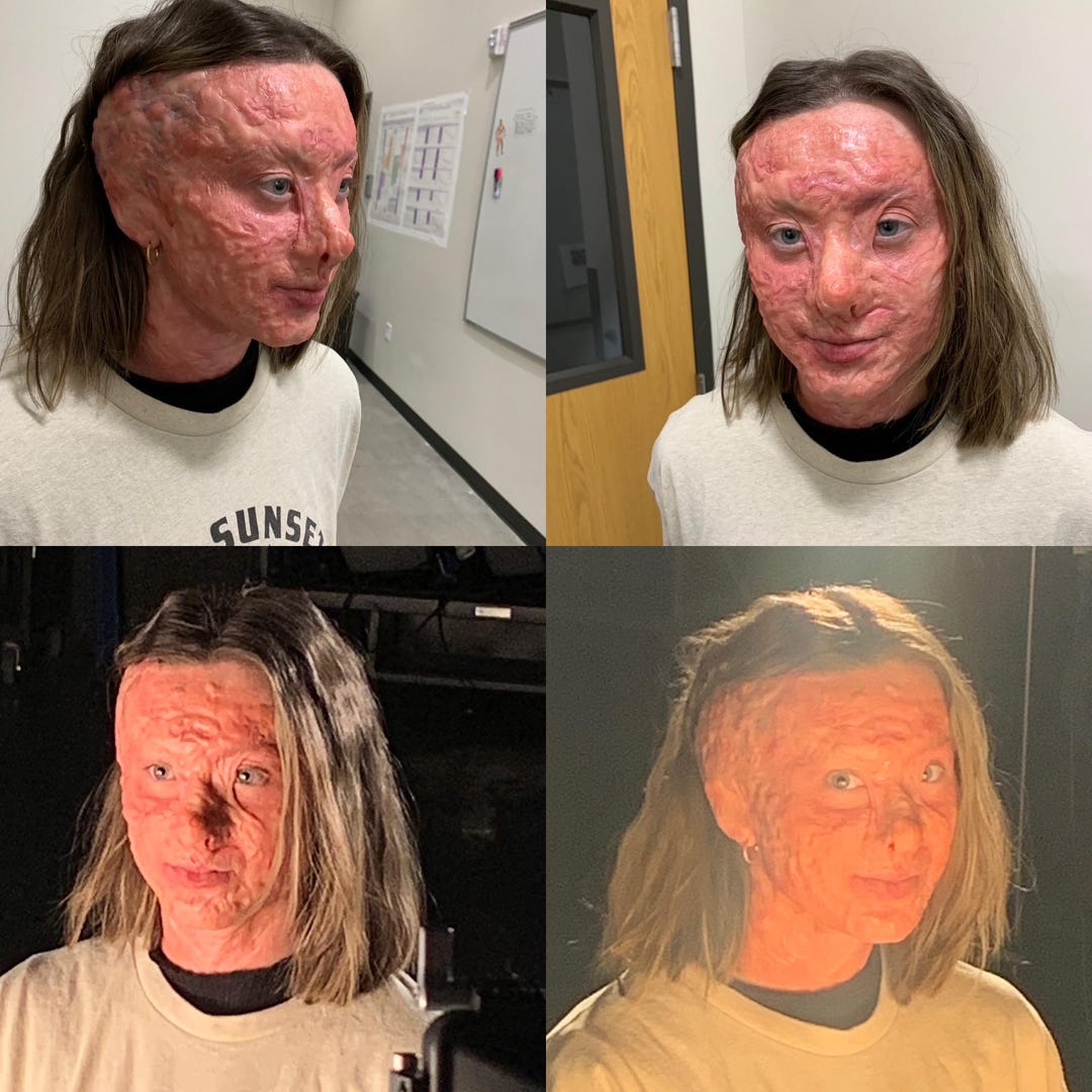 Burn Scars Silicone Prosthetic Set of 7 Overlapping Silicone ...