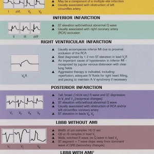Rapid Interpretation of Ekg's, Sixth Edition by Dale Dubin - Etsy