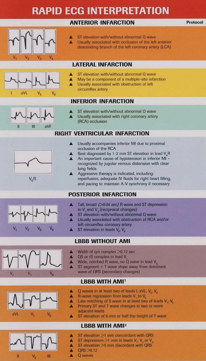 Rapid Interpretation Of Ekgs Sixth Edition By Dale Dubin Etsy